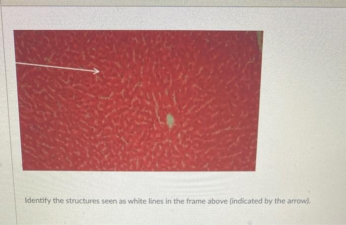 Solved Identify the structures seen as white lines in the | Chegg.com