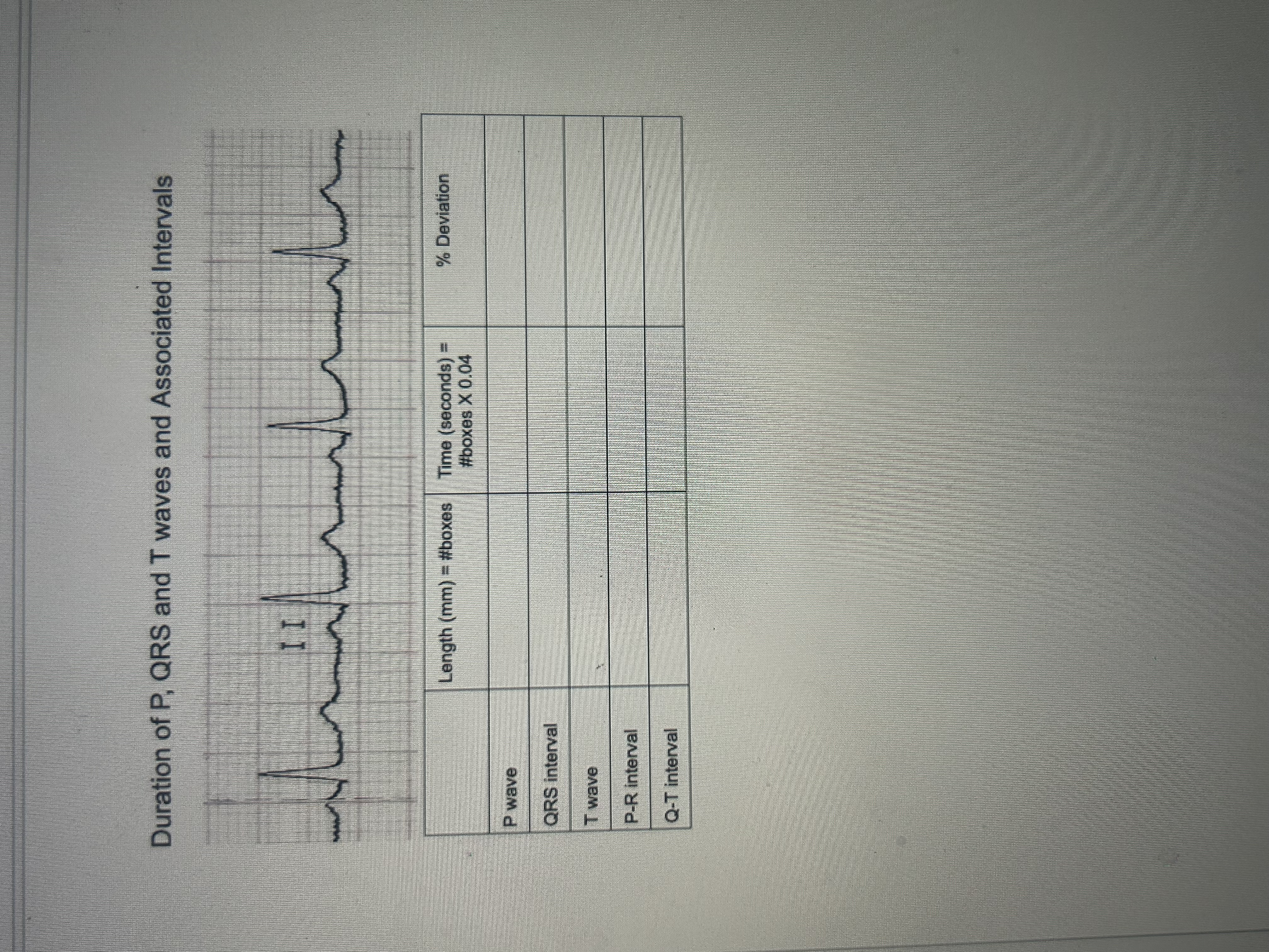 Solved Duration of P, ﻿QRS, ﻿and T waves and Associated | Chegg.com