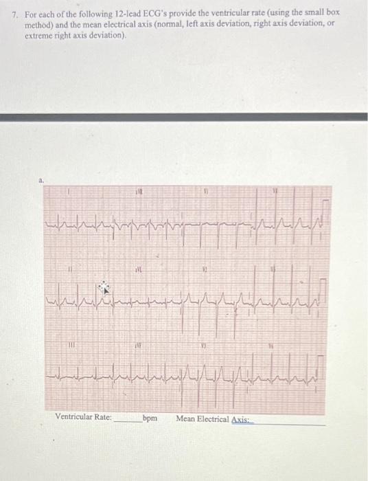 7. For each of the following 12-lead ECG's provide | Chegg.com