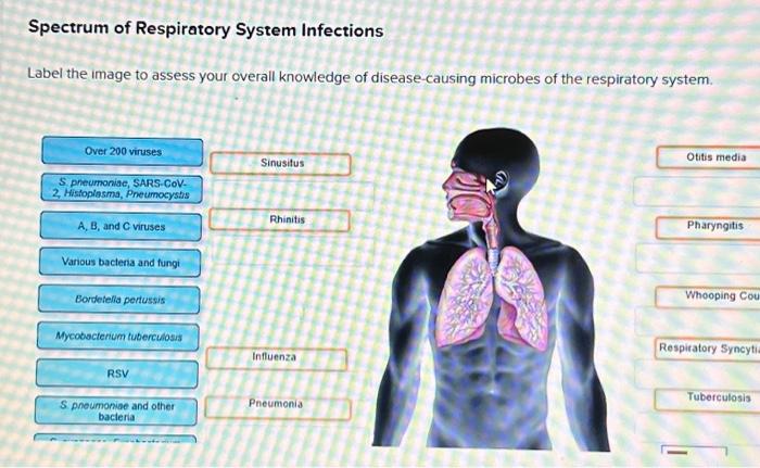 Solved Spectrum of Respiratory System Infections Label the | Chegg.com
