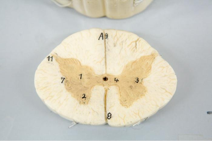 Solved please help identify all parts seen | Chegg.com Solved please help identify all parts seen | Chegg.com