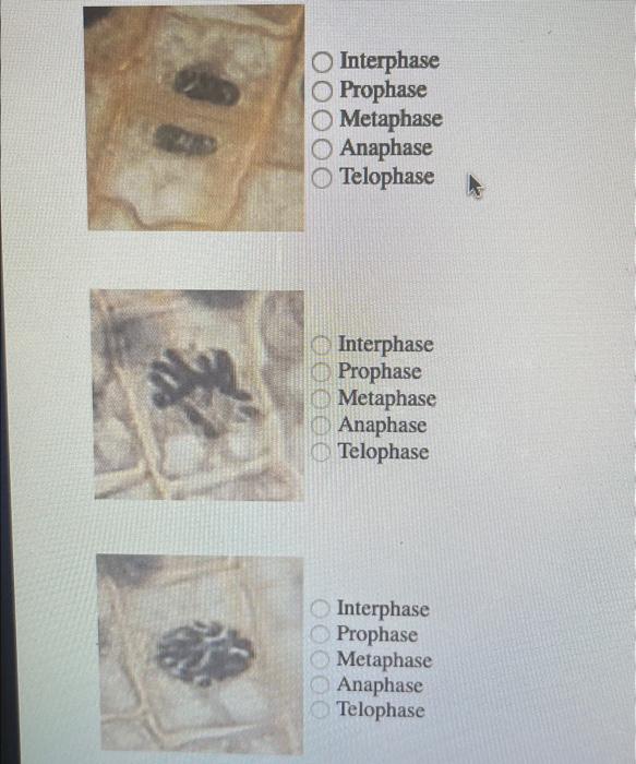 Solved Telophase Interphase Prophase Metaphase Anaphase | Chegg.com