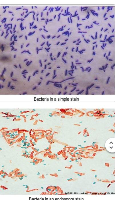 Solved : 14 Bacteria in a simple stain ASM | Chegg.com