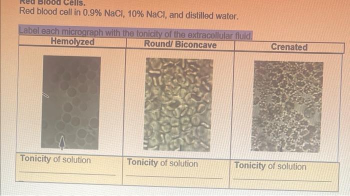 Solved Cells. Red blood cell in 0.9% NaCl, 10% NaCl, and | Chegg.com