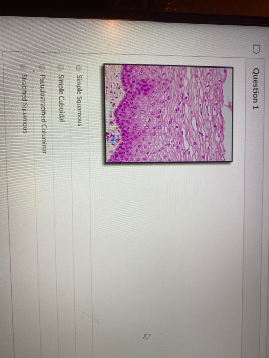 Solved Question 1 Simple Squamous Simple Cuboidal | Chegg.com