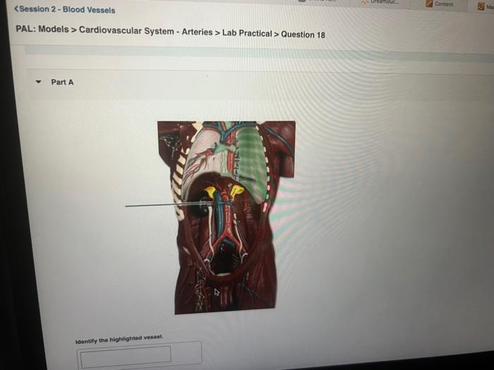 Solved PAL: Models > Cardiovascular System - Arteries > Lab | Chegg.com