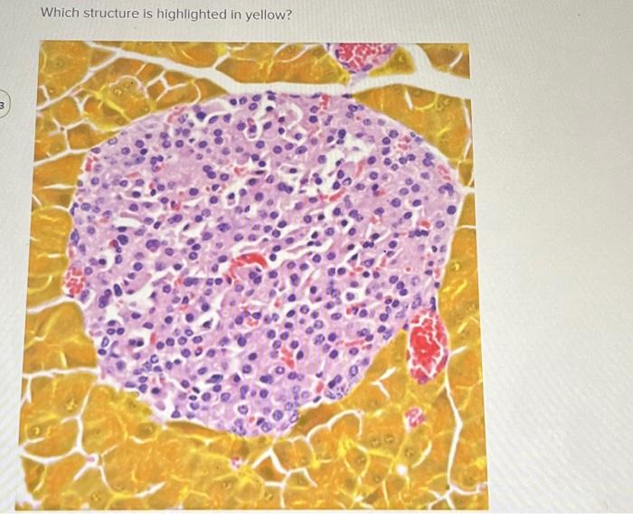 Which structure is highlighted in yellow? | Chegg.com