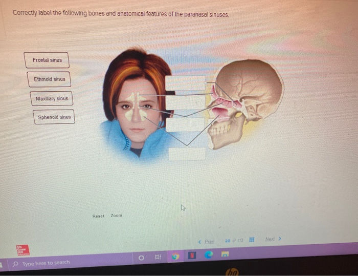 Solved Correctly Label The Following Bones And Anatomical