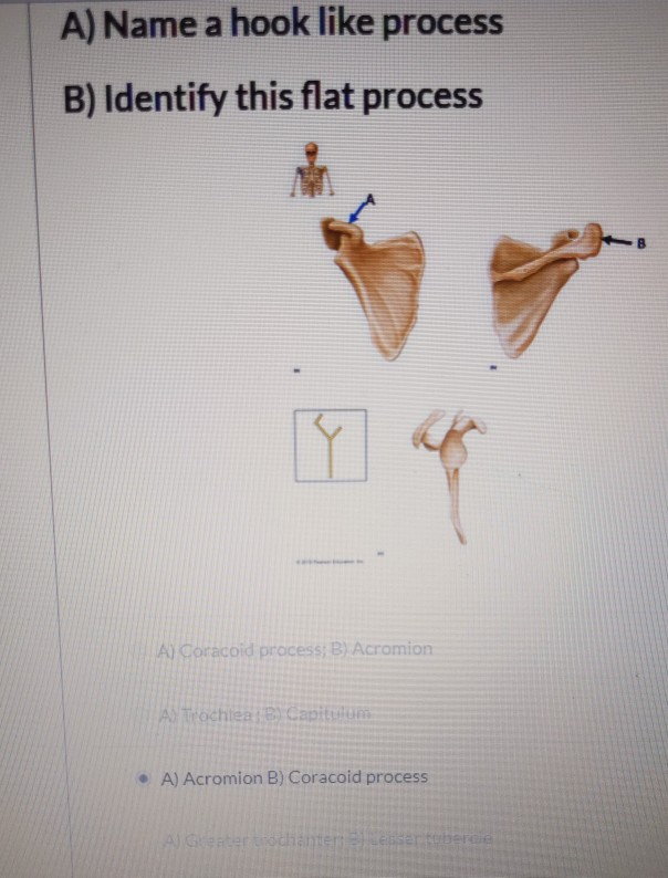 Solved A) Name a hook like process B) Identify this flat | Chegg.com