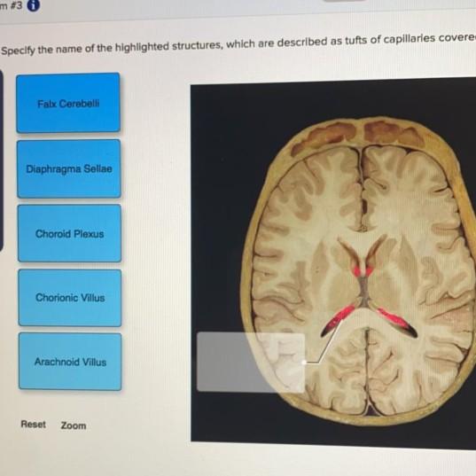 Solved m #30 Specify the name of the highlighted structures, | Chegg.com
