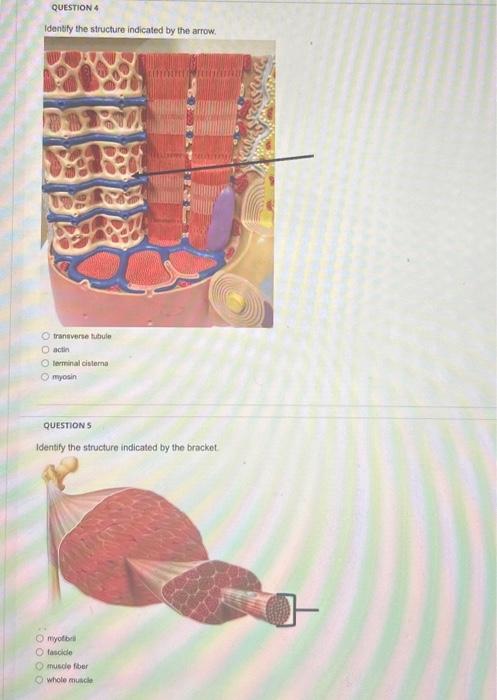 Solved Idantify the structure indicated by the arrow. | Chegg.com