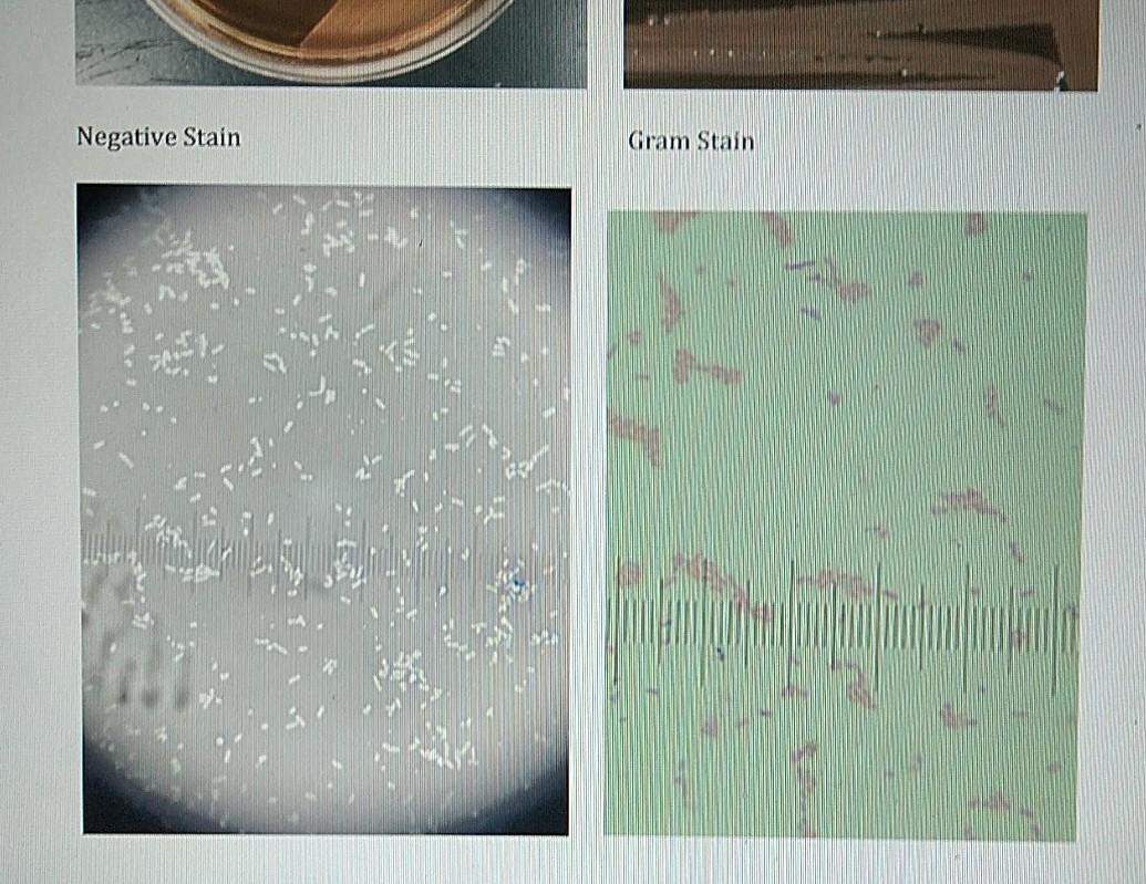 Solved MAC Plate Negative Stain Gram Stain 1 Negative | Chegg.com