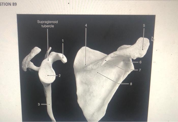 Solved STION 89 Supraglenoid tubercle 5 2. Identity the | Chegg.com