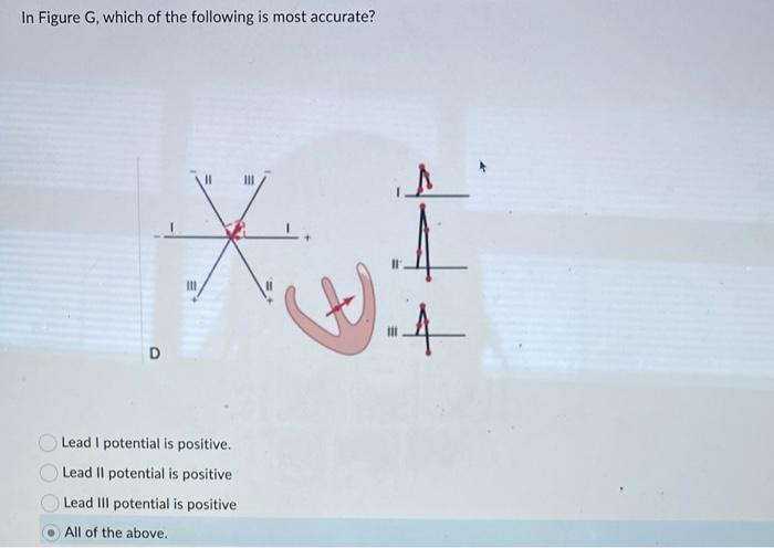 In Figure G, which of the following is most accurate? | Chegg.com