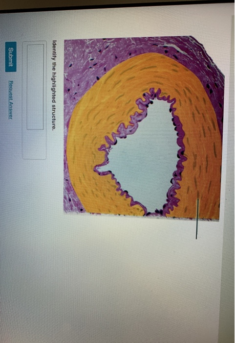 Solved Identify the highlighted vessel. Submit Request | Chegg.com