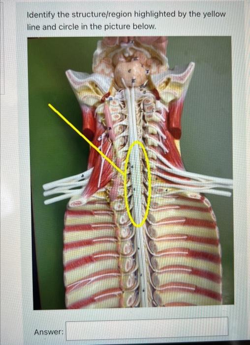 Solved Identify the structure highlighted green in the | Chegg.com