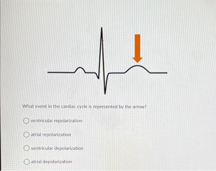 Solved What event in the cardiac cycle is represented by the | Chegg.com