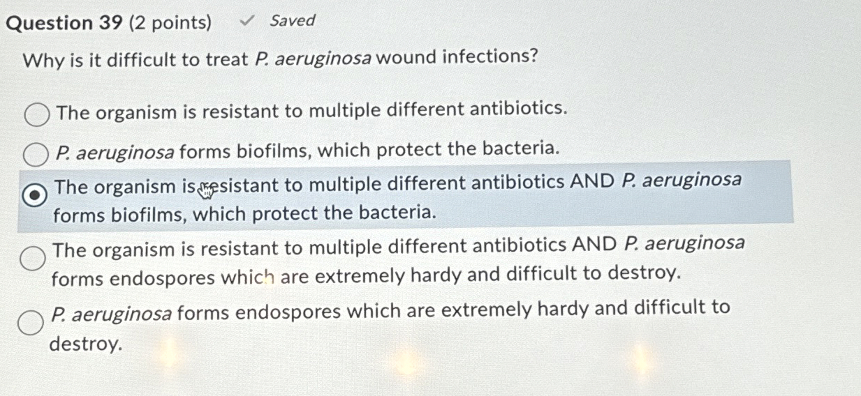 Solved Question 39 (2 ﻿points)SavedWhy is it difficult to | Chegg.com