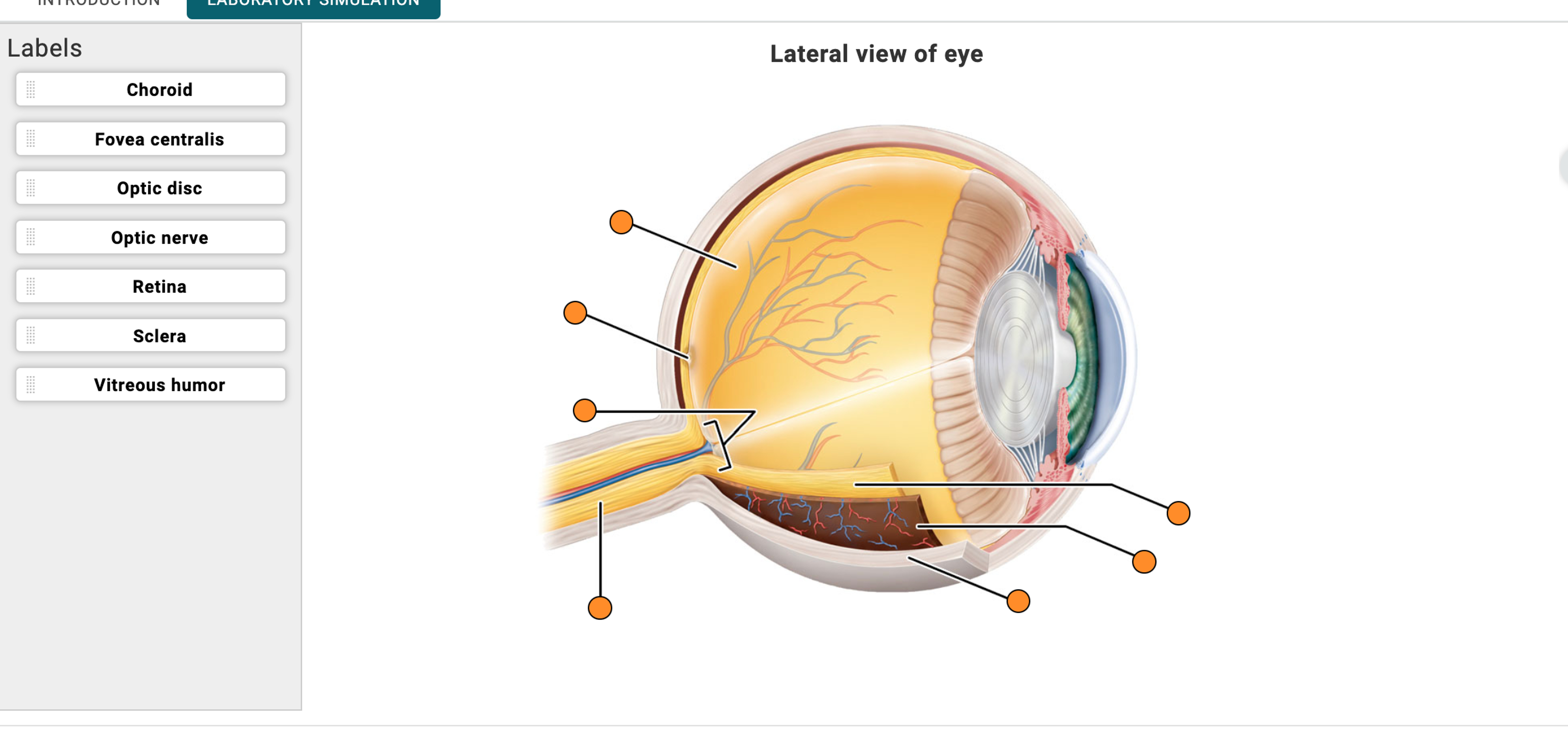 Solved phase 3 ﻿Posterior eye anatomyLateral view of | Chegg.com