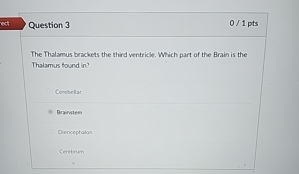 Solved Question 301ptsThe Thalamus brackets the third | Chegg.com
