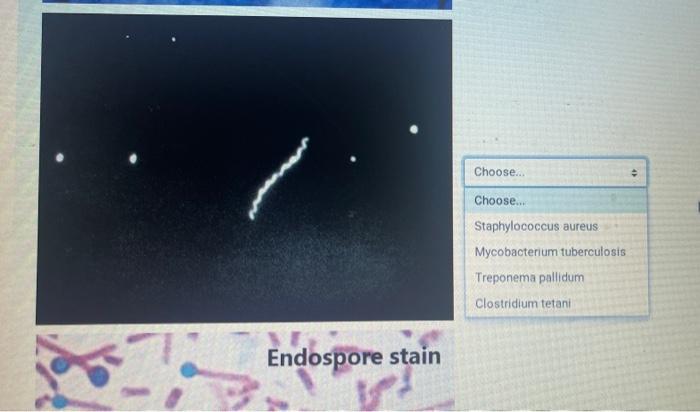 Solved Identify each bacterium shown. Choose... | Chegg.com