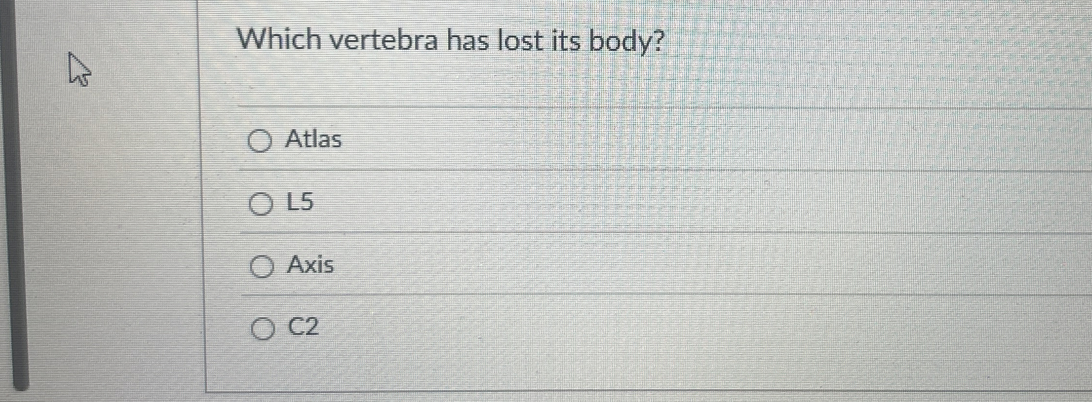 Solved Which vertebra has lost its body?AtlasL5AxisC2 | Chegg.com