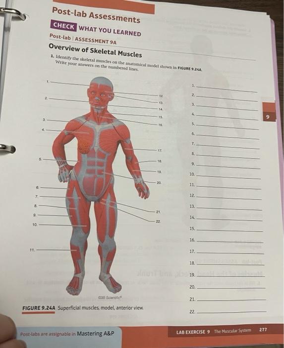 Solved Post-lab Assessments CHECK WHAT YOU LEARNED Post-lab | Chegg.com