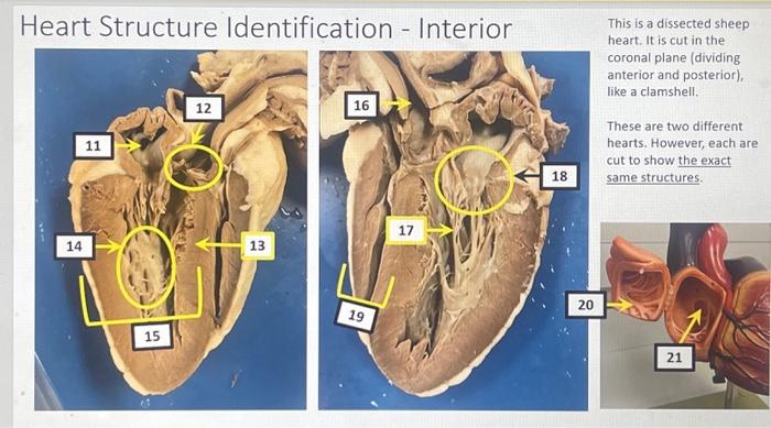 Heart Structure Identification - Interior These are | Chegg.com
