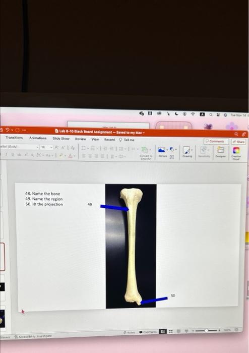 Solved name the parts with an arrow and identify the bone. | Chegg.com