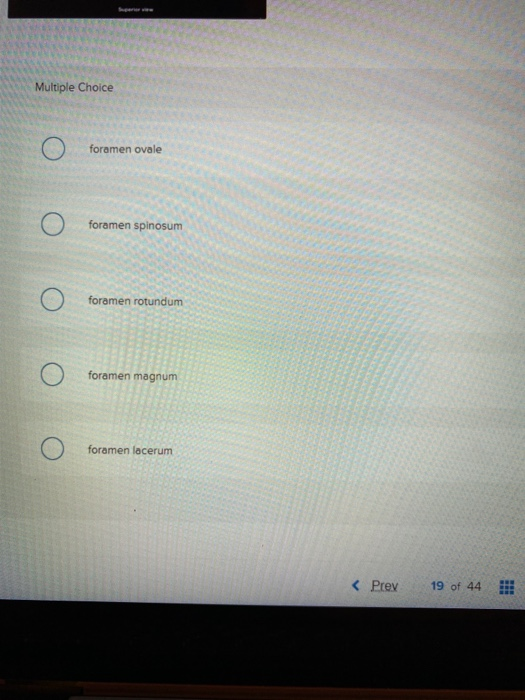 Solved Which structure is highlighted? Multiple Choice | Chegg.com