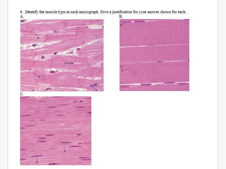 Solved 6. Identify the muscle type in each micrograph. Give | Chegg.com