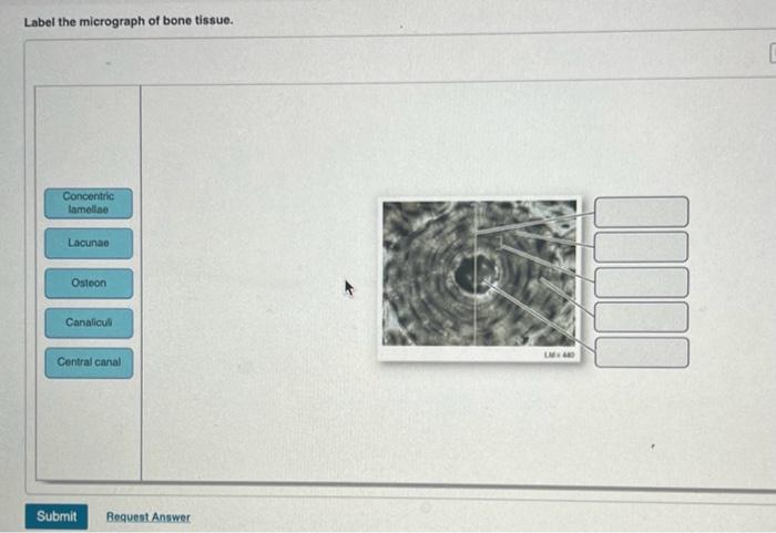 Solved Label the micrograph of bone tissue. | Chegg.com