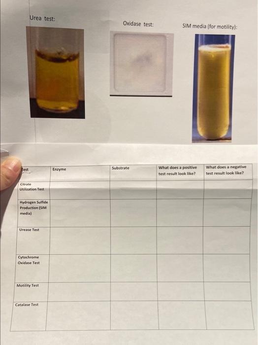 Solved Urea test: Oxidase test: SIM media (for motility: | Chegg.com