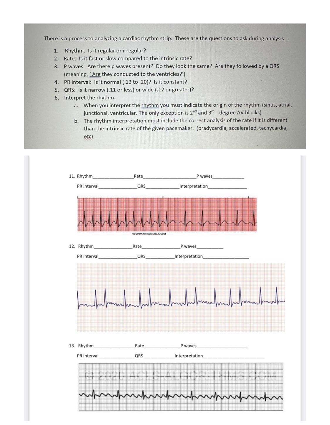 Solved Rhythm_PR intervaRate._QRSP | Chegg.com
