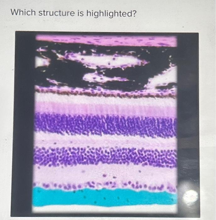 Solved Which structure is highlighted? Multiple Choice rods | Chegg.com