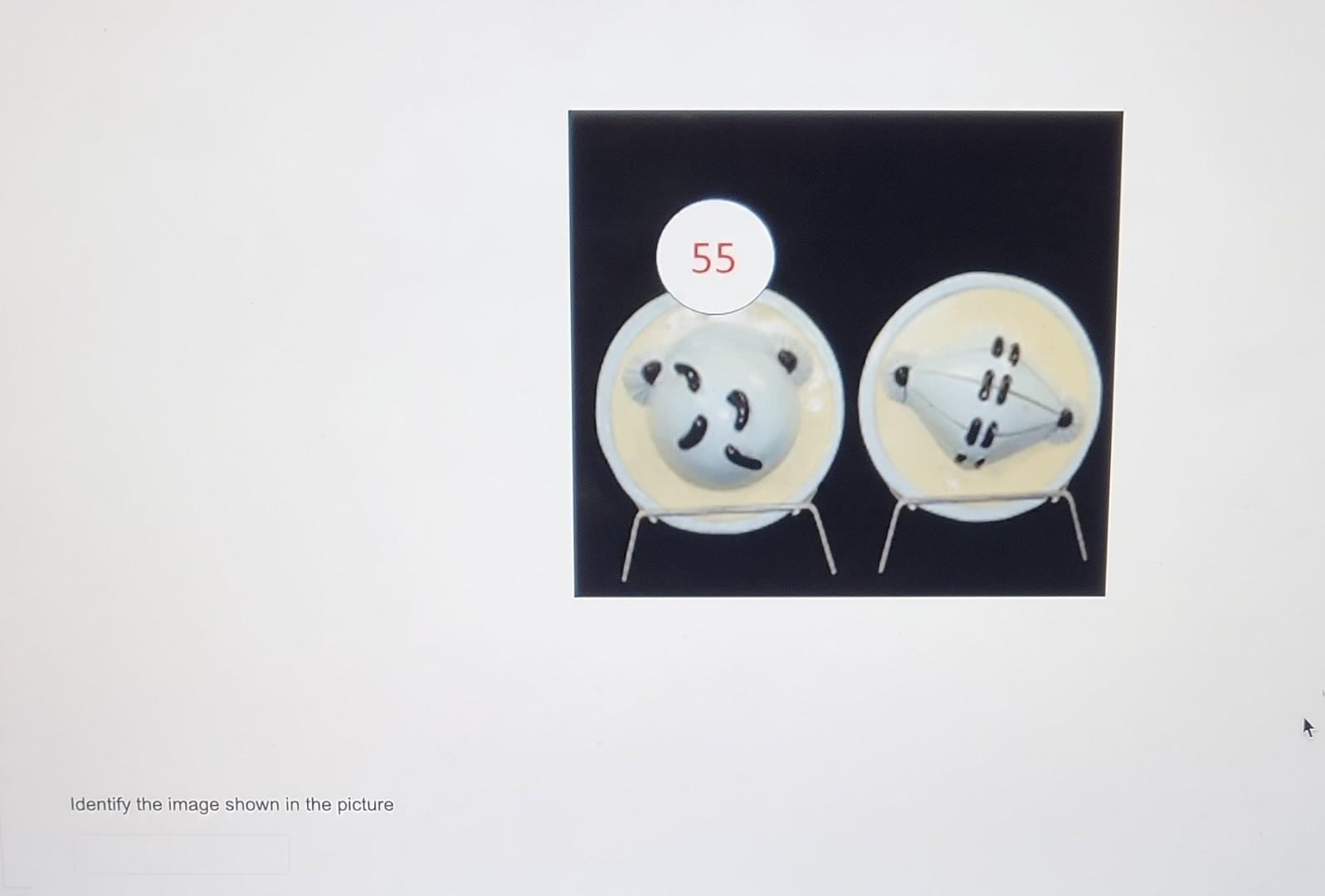 Solved Identify the image shown in the picture | Chegg.com