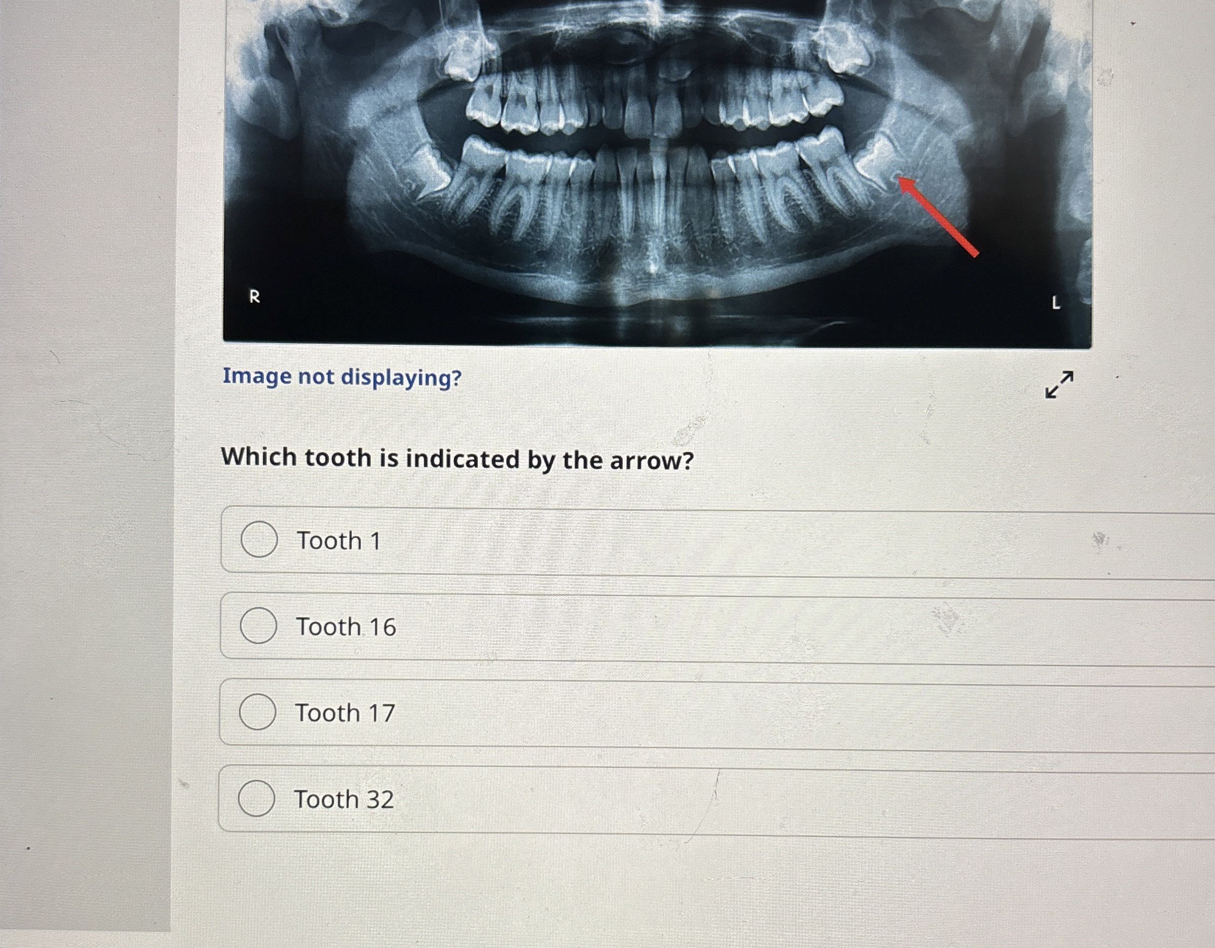 Solved Which tooth is indicated by the arrow?Tooth 1Tooth | Chegg.com