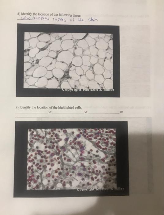 Solved 10) Identify the location of the highlighted fiber. | Chegg.com