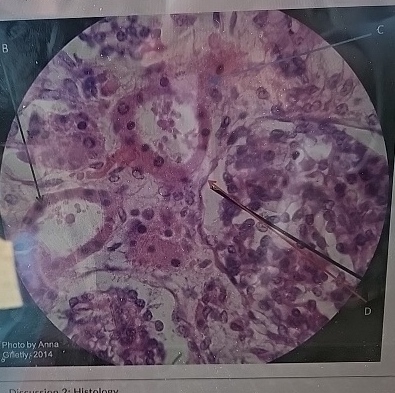 Solved looking at the entire photomicrograph, what is the | Chegg.com