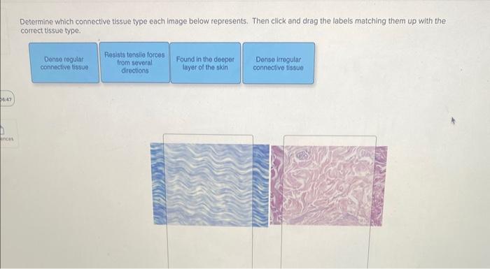 Solved Determine which connectlve tissue type each image | Chegg.com