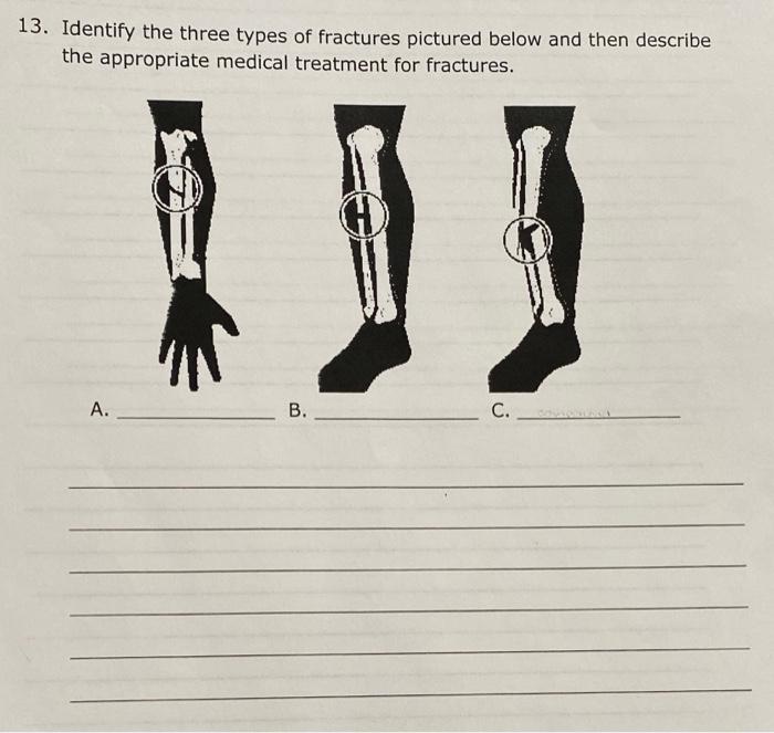 Solved 13. Identify the three types of fractures pictured | Chegg.com