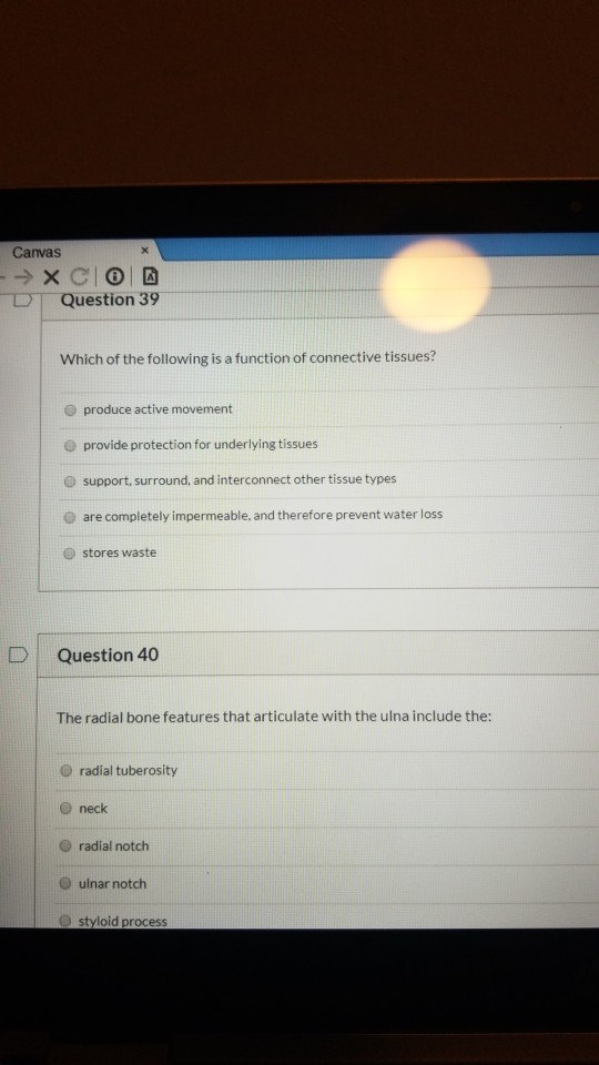 Solved Canvas - XCIO D Question 39 Which of the following is | Chegg.com Solved Canvas - XCIO D Question 39 Which of the following is | Chegg.com