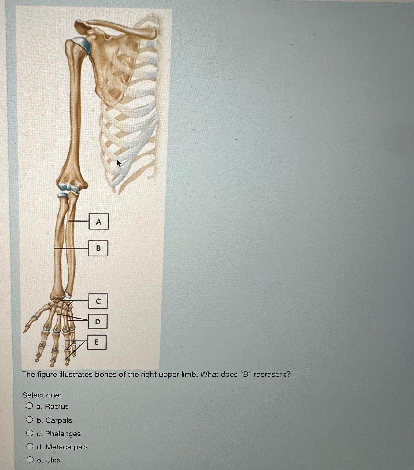 Solved The figure illustrates bones of the right upper limb. | Chegg.com