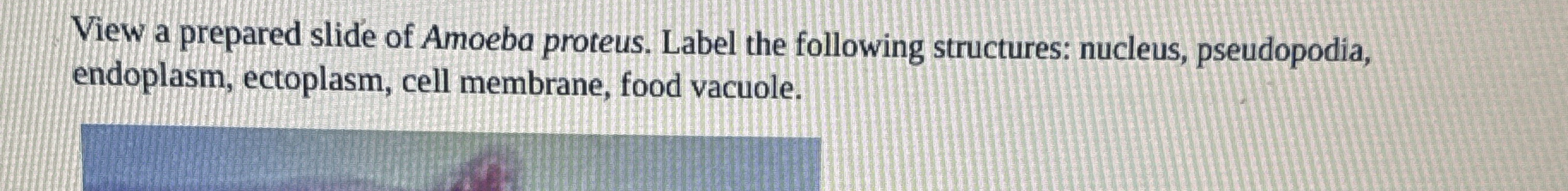 Solved View a prepared slide of Amoeba proteus. Label the | Chegg.com