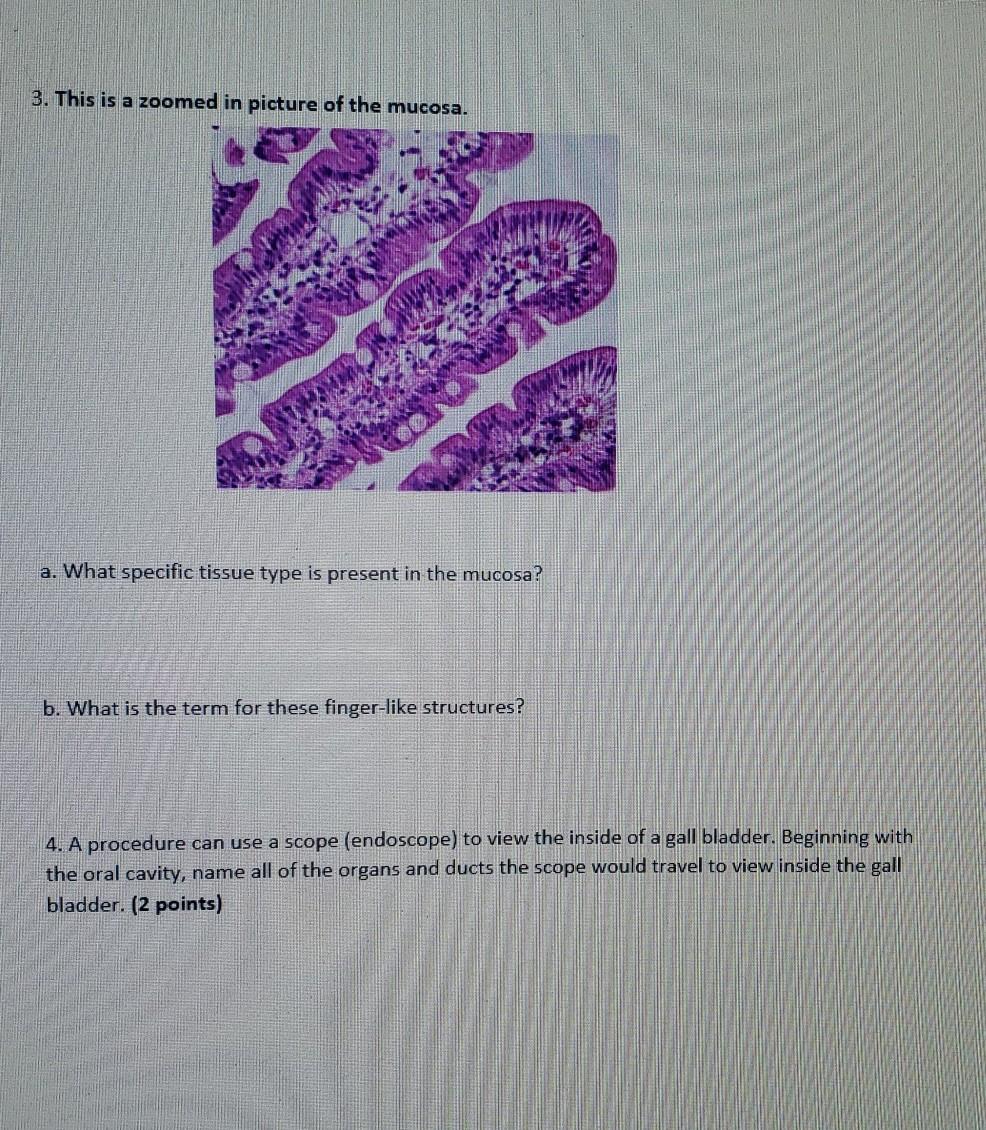 Solved 2. Duodenum slide: submucosa А B a. What layer is at | Chegg.com