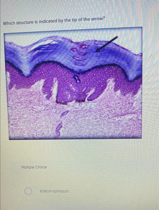 Solved Which structure is indicated by the tip of the arrow? | Chegg.com