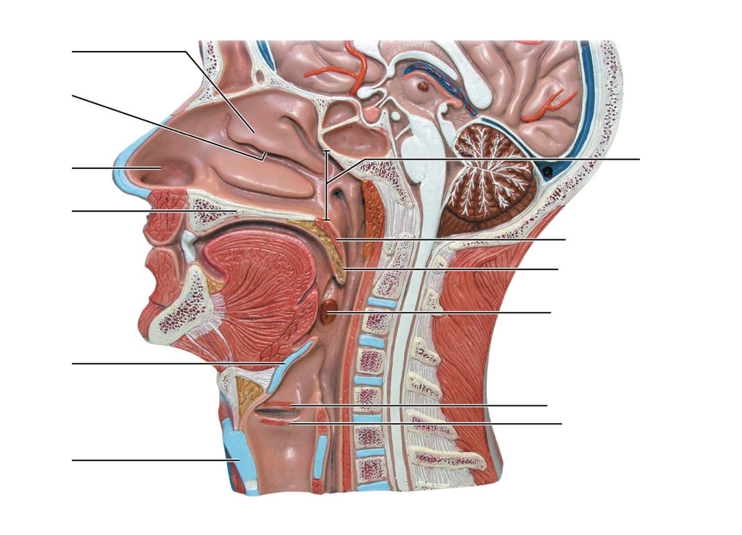 Solved Please label this figure | Chegg.com