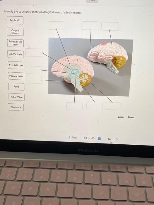 Solved saved Identify the structures on this midsagittal | Chegg.com
