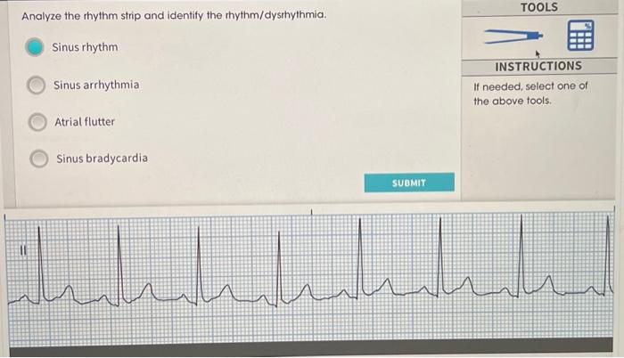 Sinus Arrhythmia Rhythm Strip