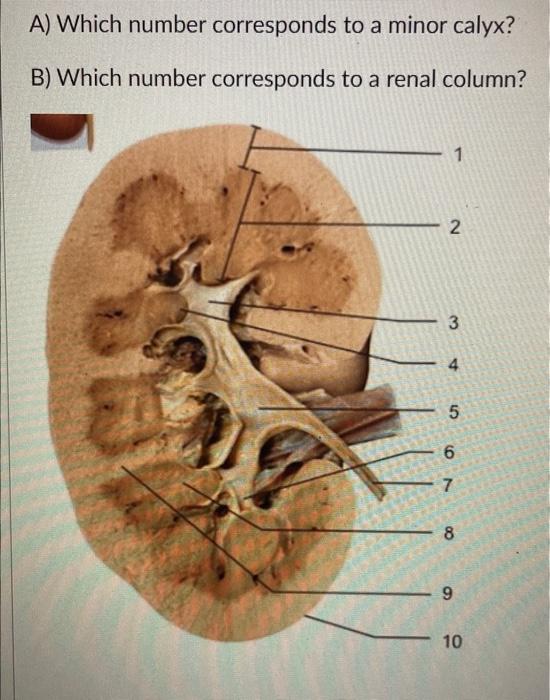 Solved A) Which number corresponds to a minor calyx? B) | Chegg.com